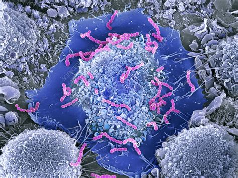 Macrophages Infected With Streptococcus Pyogenes Sem Stock Image