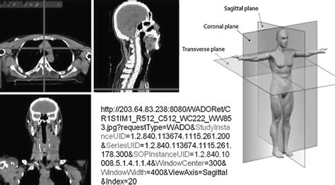 user interface for three cross sectional views of a 3d image voxel