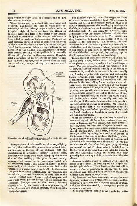 Hydronephrosis Its Causes Diagnosis And Treatment Pmc