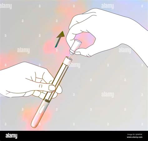 Dry Swab For Vaginal Self Sampling Stock Photo Alamy