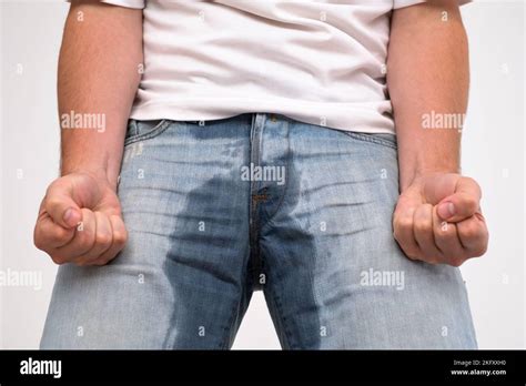 Man With Prostate Complication Have Problem With Urinary Incontinence Stock Photo Alamy