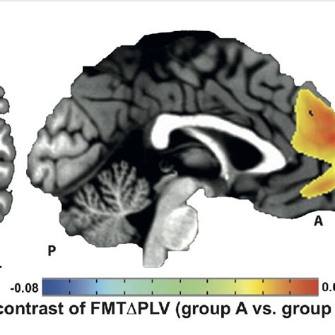 Pdf Tacs Phase Locking Of Frontal Midline Theta Oscillations Disrupts