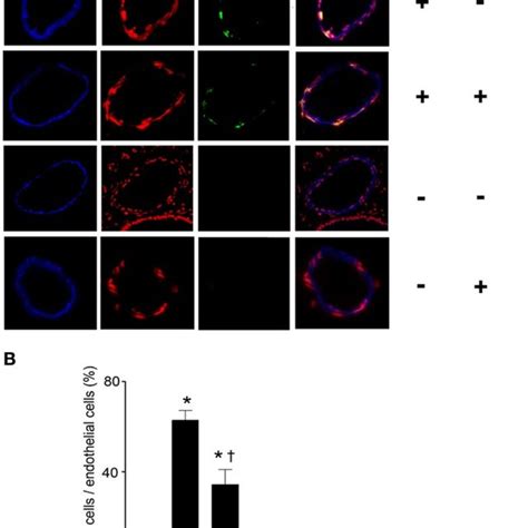 Gsh Supplementation Inhibits The Lps Induced Endothelial Cell Apoptosis