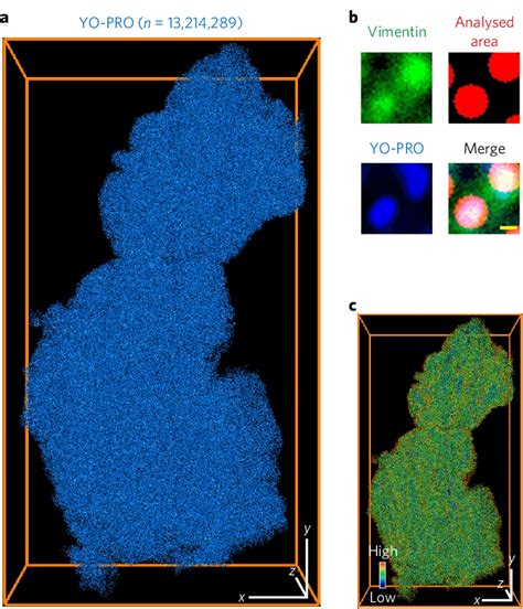 Single Cell Analysis Of A Human Ffpe Tumour A Counting All The