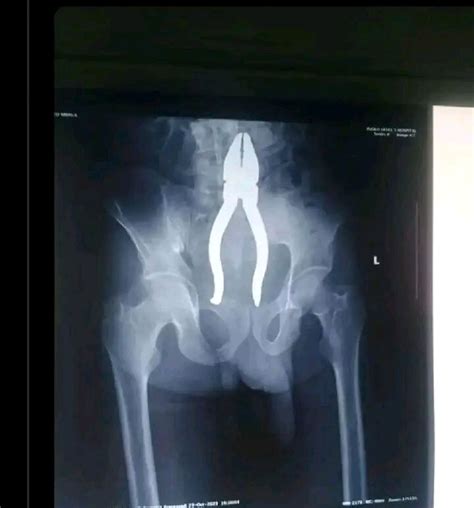 Sex Toy Sex Relationships Kenya Talk