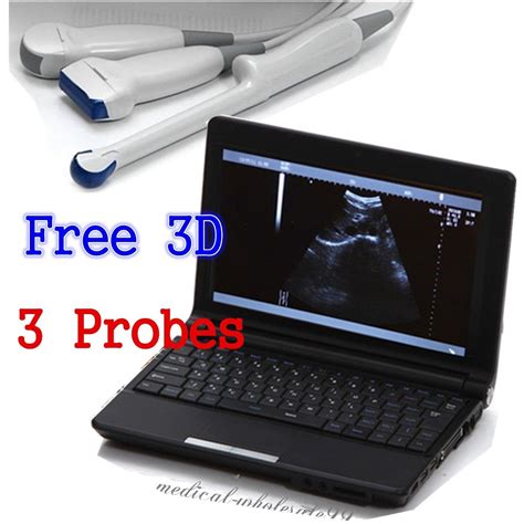 Laptop Ultrasound Scannermachine With Convex And Linear And