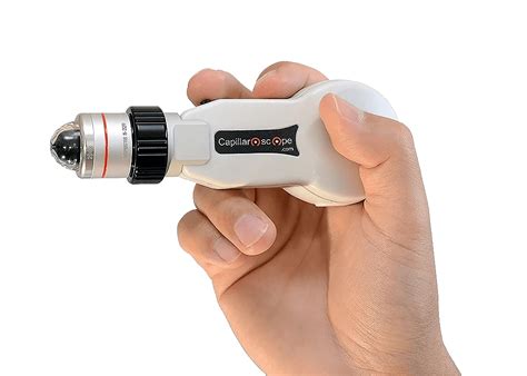 Capilaroscopios Modelos Destacados Y Principales Fabricantes