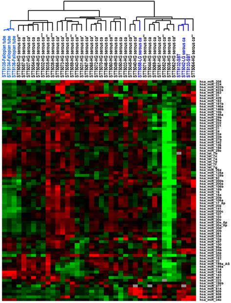 Unsupervised Hierarchical Clustering Of 37 Ovarian Serous Tumors And 3