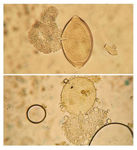 Exploded Trichuris And Toxocara Eggs I Finished My Microscopy And Left The Slide For A Few
