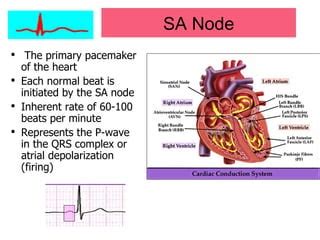Cardiac Arrhythmias Ppt