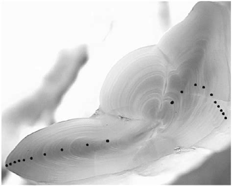 The Surface Of The Fracture Of A Kildin Cod Otolith 10 Years Of Age