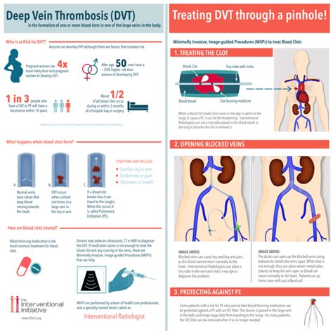 Deep Vein Thrombosisdvt Treatment In Denver Co Mips