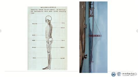 王凯教授：脊柱的矢状位和冠状位平衡 脑医汇