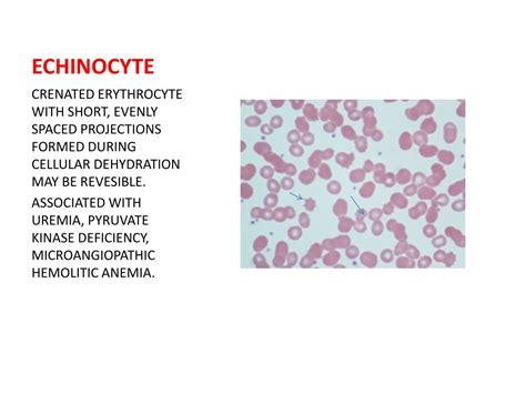 Ppt Hematology Powerpoint Presentation Free Download Id2241331