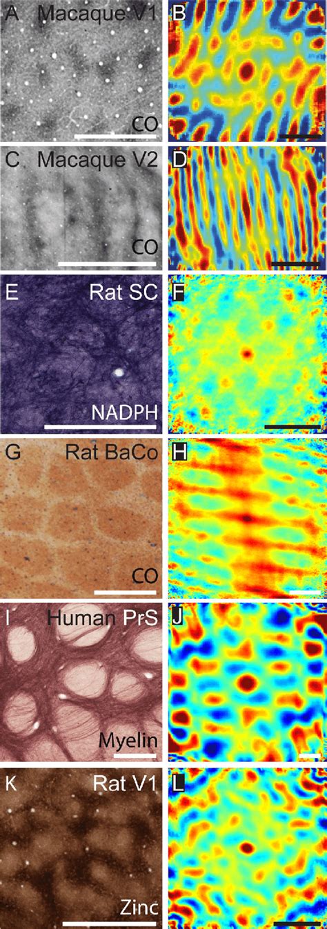 Structural Analysis Of Different Brain Regions Using Spatial Download Scientific Diagram