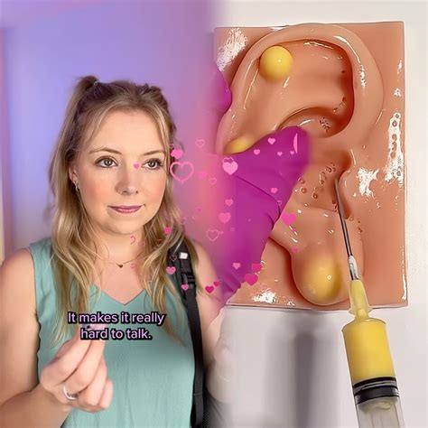 Pov Fup Foryou Storytime Foryoupage Viral Fyp Fypシ゚viral Fypシ Funny Skit Youtube