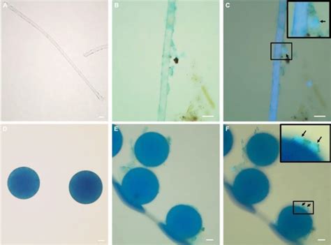 Bugbitten Terrestrial Pathogens And Microplastics Hitchhikers Guide