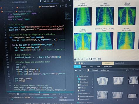 Deeplearning Artificialintelligence Machinelearning Computervision