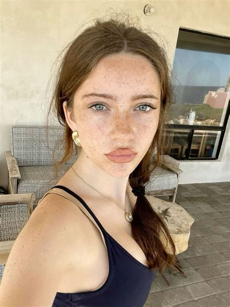 Freckles Girl