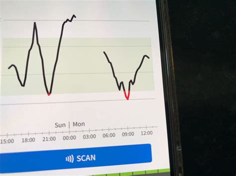 Type 2 Freestyle Libre Sensor Diabetes Forum The Global Diabetes Community