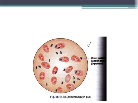 Streptococcus Species Pptx