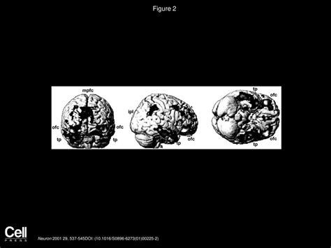 Hugo D Critchley Christopher J Mathias Raymond J Dolan Neuron Ppt Download