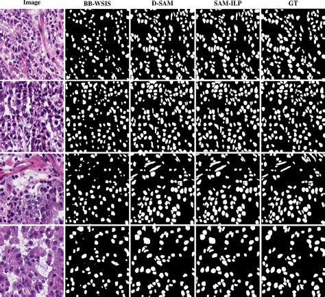 Figure 1 From Guided Prompting In Sam For Weakly Supervised Cell