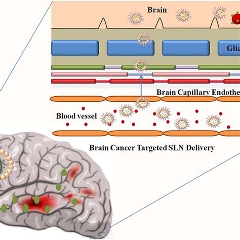 Schematic Representation Of Brain‐targeted Sln Delivery Download Scientific Diagram