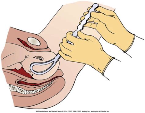 EXAM Procedure Flashcards Quizlet