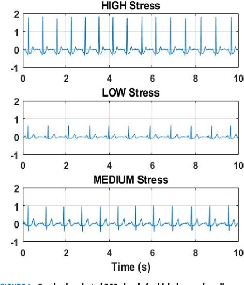 Figure 2 From Ecg Based Drivers Stress Detection Using Deep Transfer Learning And Fuzzy Logic