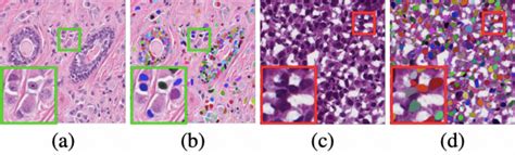 Panoptic Segmentation Enables Real World Computer Vision In Healthcare