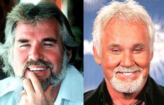 Kenny Rogers Plastic Surgery Face Lift And Botox Famewatcher