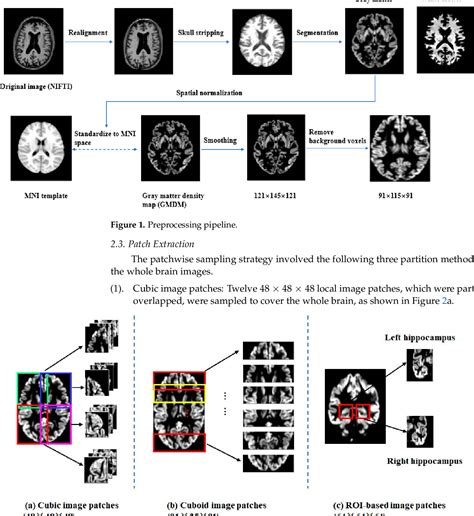 Figure 1 From Effects Of Patchwise Sampling Strategy To Three Dimensional Convolutional Neural