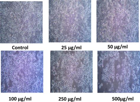 Cell Viability Images Taken Using Optical Microscope 24h Post Treatment