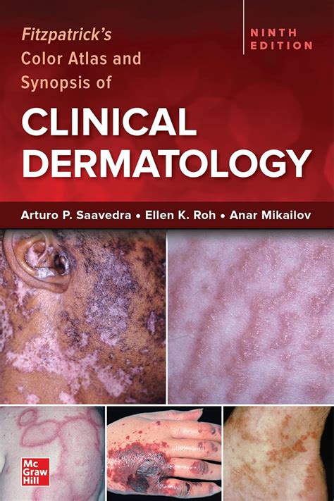 Fitzpatricks Color Atlas And Synopsis Of Clinical Dermatology Ninth Edition Saavedra Arturo