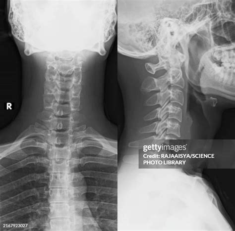 Head Neck Spine Anatomy Head And Neck Anatomy Wikipedia