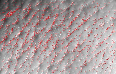 Java Skin Pores Analysis Using Blob Detection In Opencv Stack Overflow