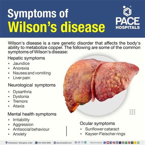 Wilsons Disease Symptoms Causes Prevention And Treatment