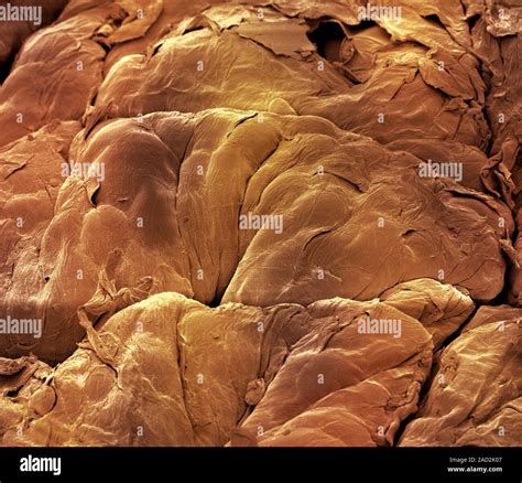 Skin Mole Coloured Scanning Electron Micrograph Sem Of Detail From A