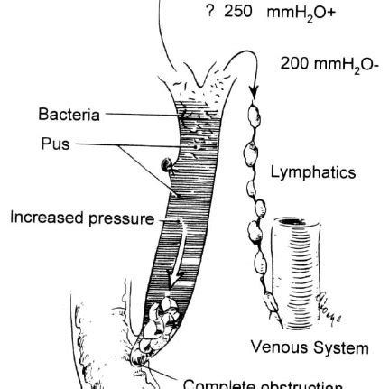 PDF Acute Cholangitis