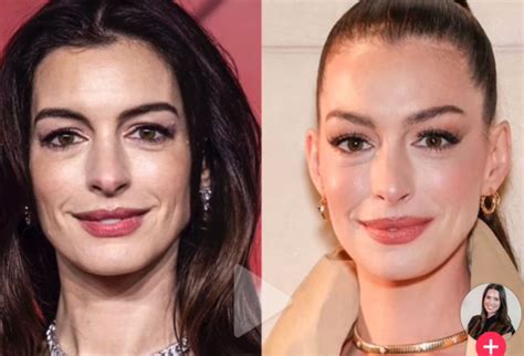 Welcome To Botox Clinics