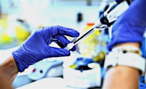 Who For Rapid Access To Mpox Diagnostic Tests The Foreign Affairs News