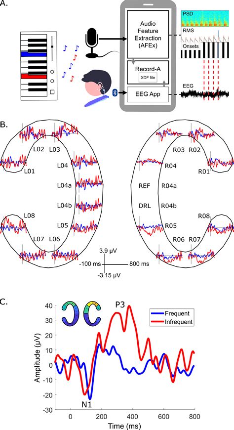 Recording Brain Activity With Ear Electroencephalography