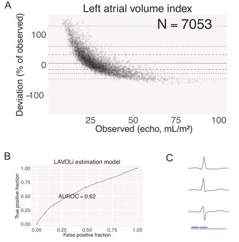 Fig S1 Estimating Left Atrial Volume Index Using Patient Level Ecg