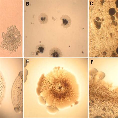 Scanning Electron Microscopy A Control Mycobacterium Tuberculosis Download Scientific