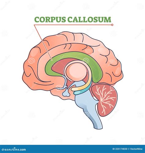 Corpus Callosum