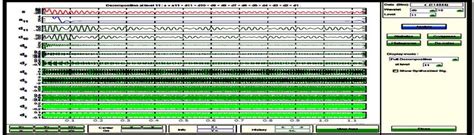 A Full Level Decomposition Of Healthy Motor Download Scientific Diagram