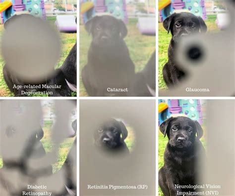 Below Are Some Examples Of What The World Looks Like With Vision Loss