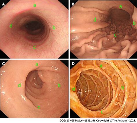 Orientation In Upper Gastrointestinal Endoscopy—the Only Way Is Up