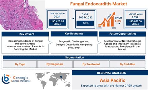Fungal Endocarditis Market Size Share Trends Demand And Forecast